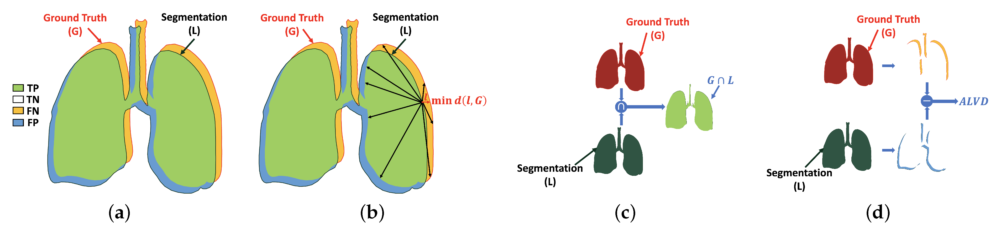 Sensors | Free Full-Text | Precise Segmentation of COVID-19 Infected ...