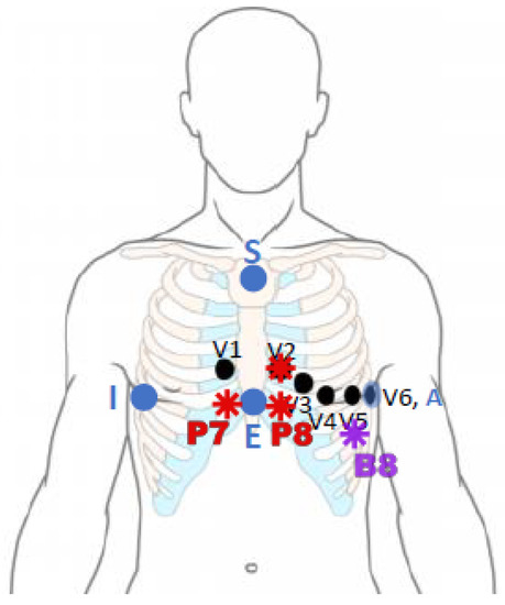 Sensors Free Full Text Lead Reconstruction Using Artificial Neural Networks For Ambulatory