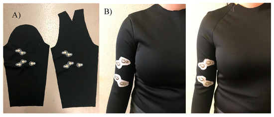The Effect of Sleeve Pattern and Fit on E-Textile Electromyography (EMG ...
