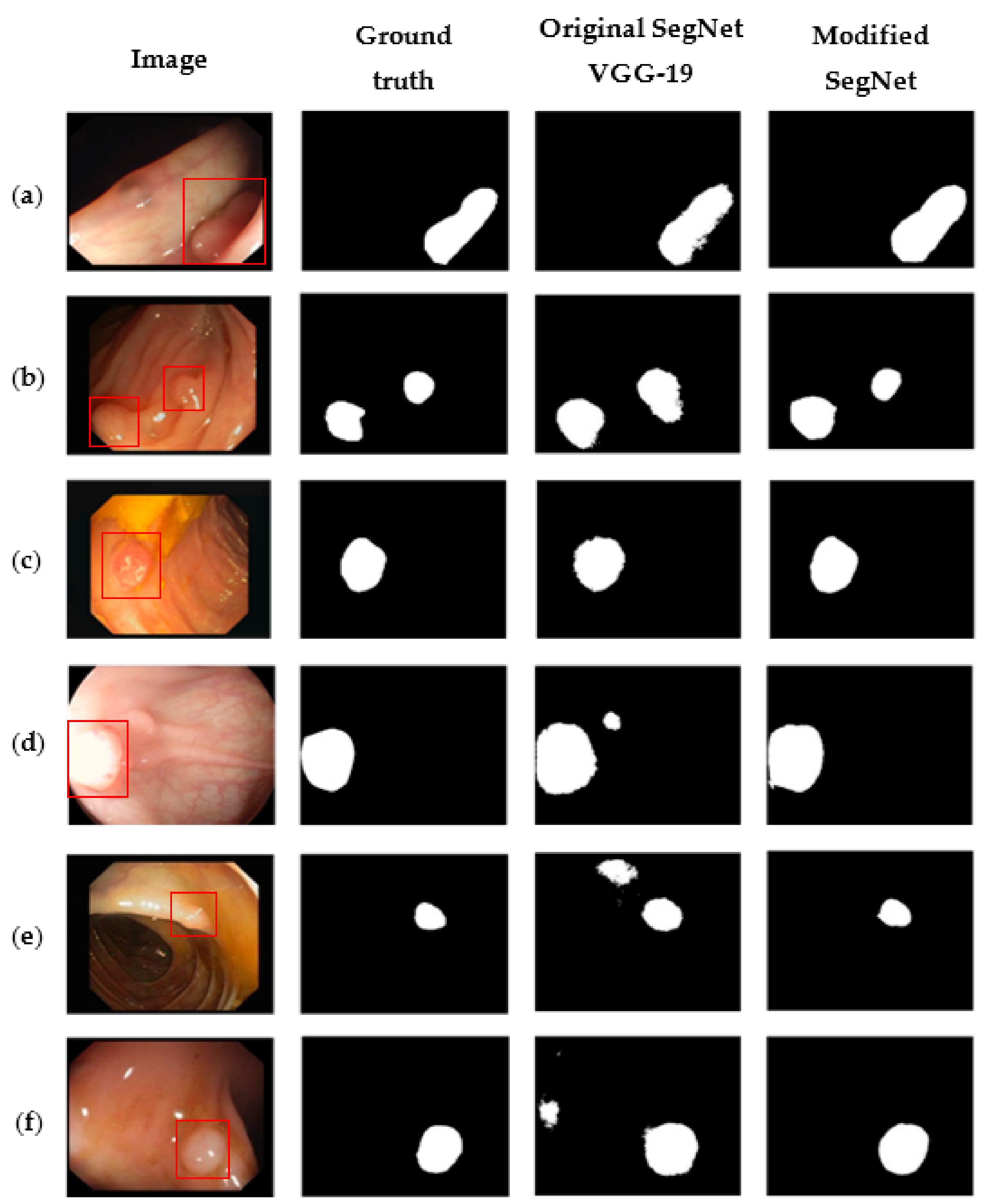 Sensors Free Full Text Automatic Polyp Segmentation In Colonoscopy Images Using A Modified