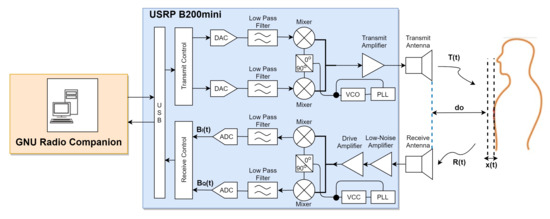 Portable Micro-Doppler Radar with Quadrature Radar Architecture for Non ...