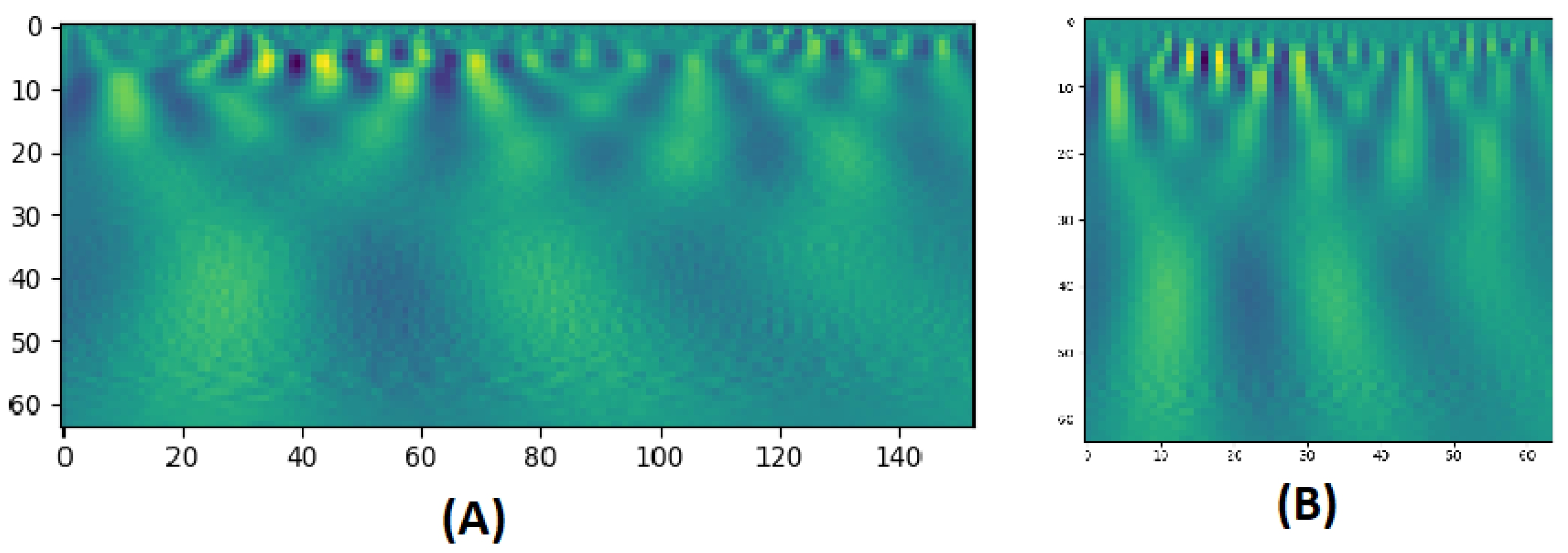 A CNN Deep Local and Global ASD Classification Approach with Continuous Wavelet Transform Using ...
