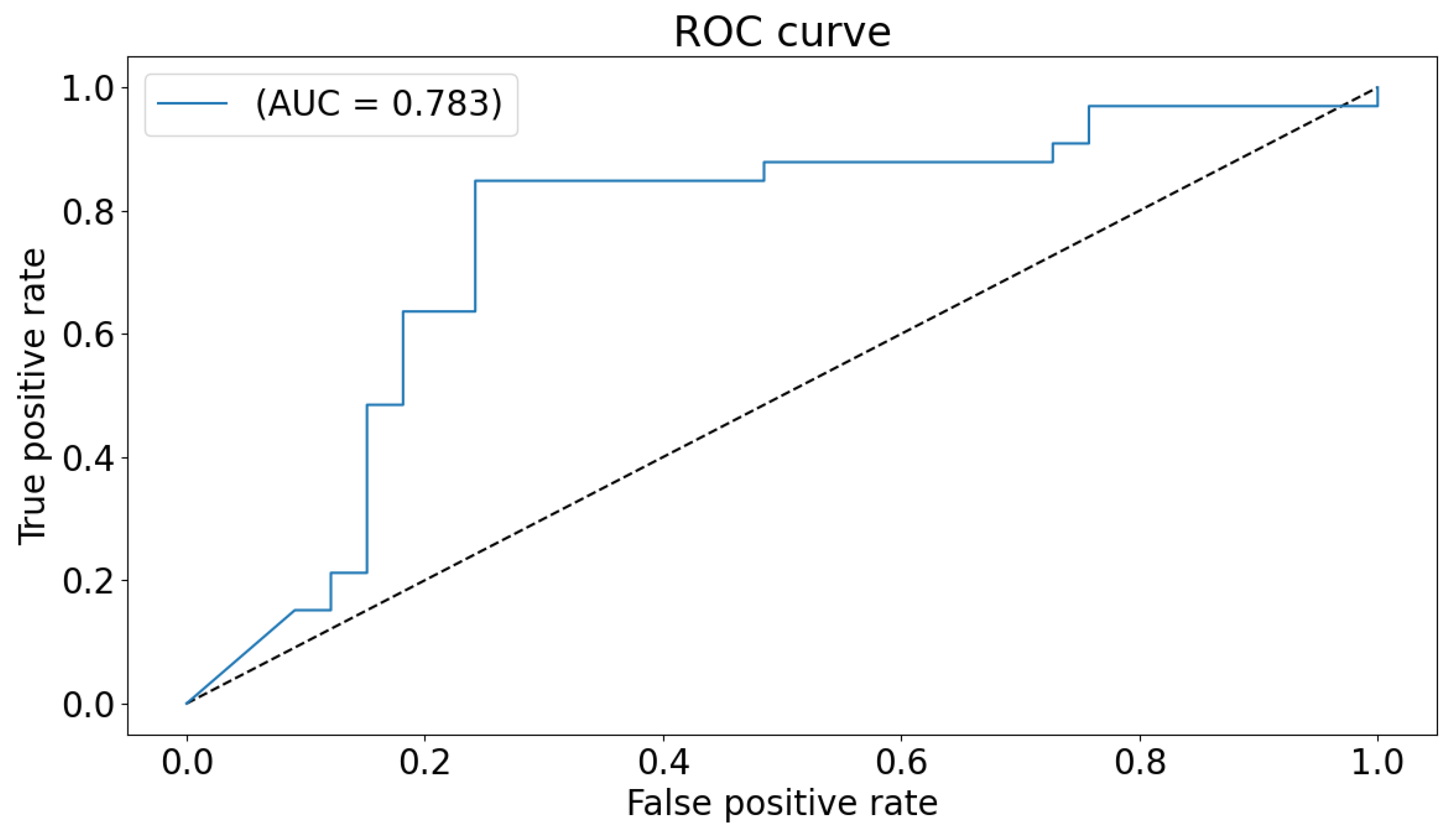 A CNN Deep Local and Global ASD Classification Approach with Continuous Wavelet Transform Using ...