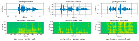 Sensors | Free Full-Text | Age and Gender Recognition Using a ...