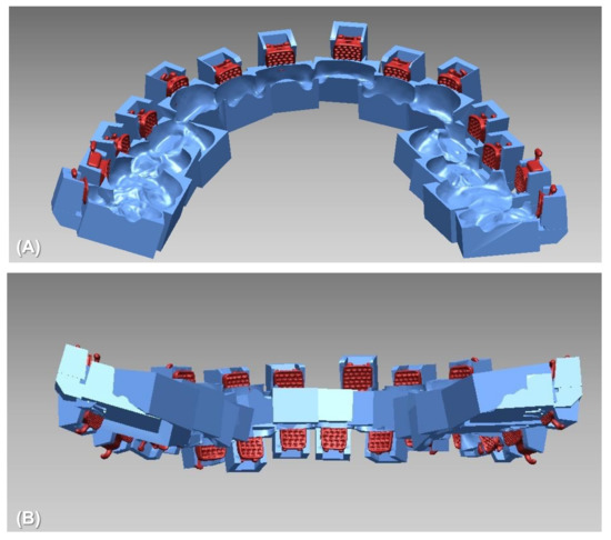 Three-Dimensional Digital Superimposition of Orthodontic Bracket ...