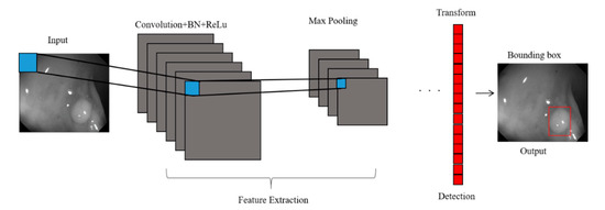 Colorectal Polyp Image Detection and Classification through Grayscale ...