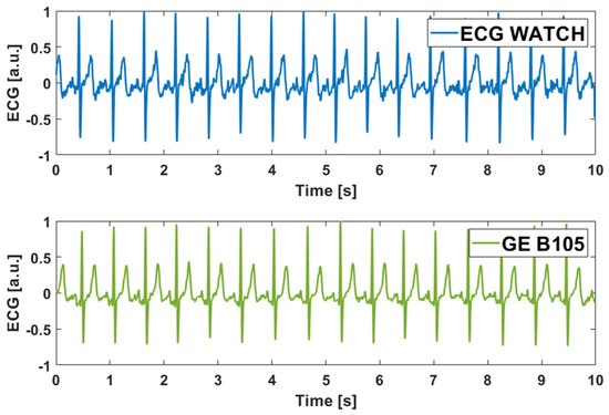 Anytime ECG Monitoring through the Use of a Low-Cost, User-Friendly ...