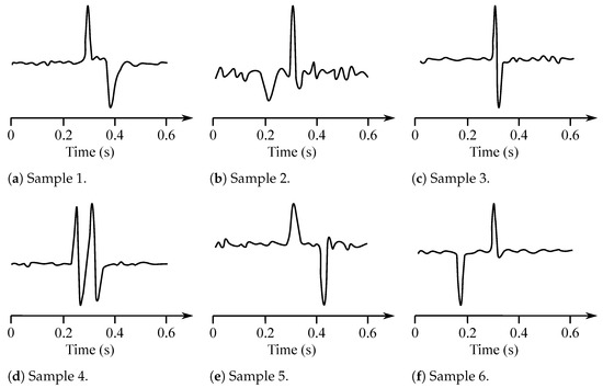 Advanced Bioelectrical Signal Processing Methods: Past, Present, and ...