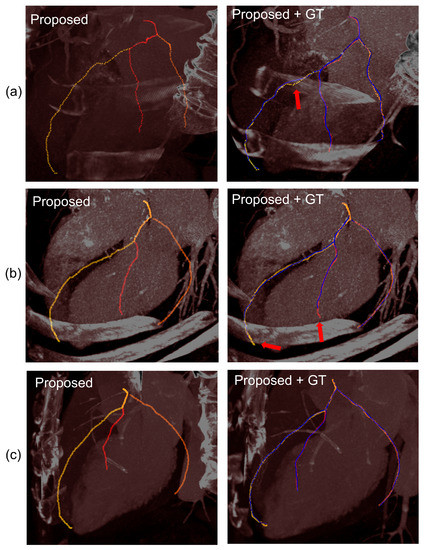 Sensors | Free Full-Text | Deep Recursive Bayesian Tracking for Fully Automatic Centerline ...