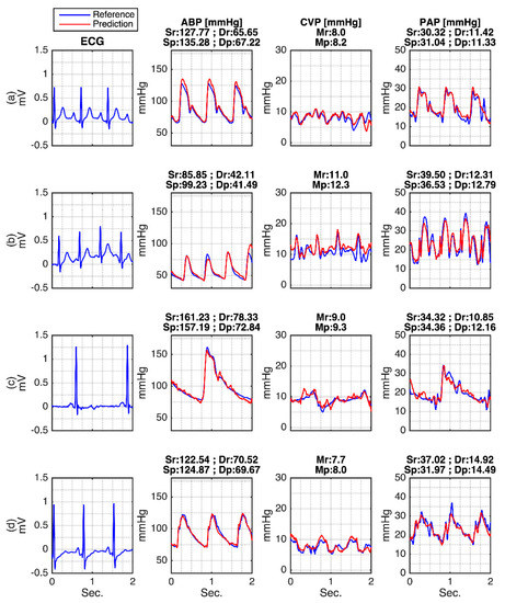Sensors | Special Issue : Advanced Signal Processing in Wearable ...