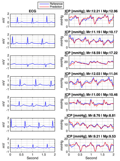 Sensors | Special Issue : Advanced Signal Processing in Wearable ...