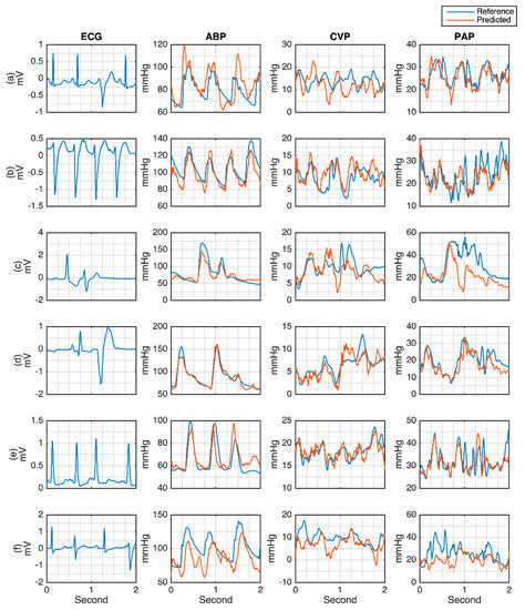 Non-Invasive Hemodynamics Monitoring System Based on ...