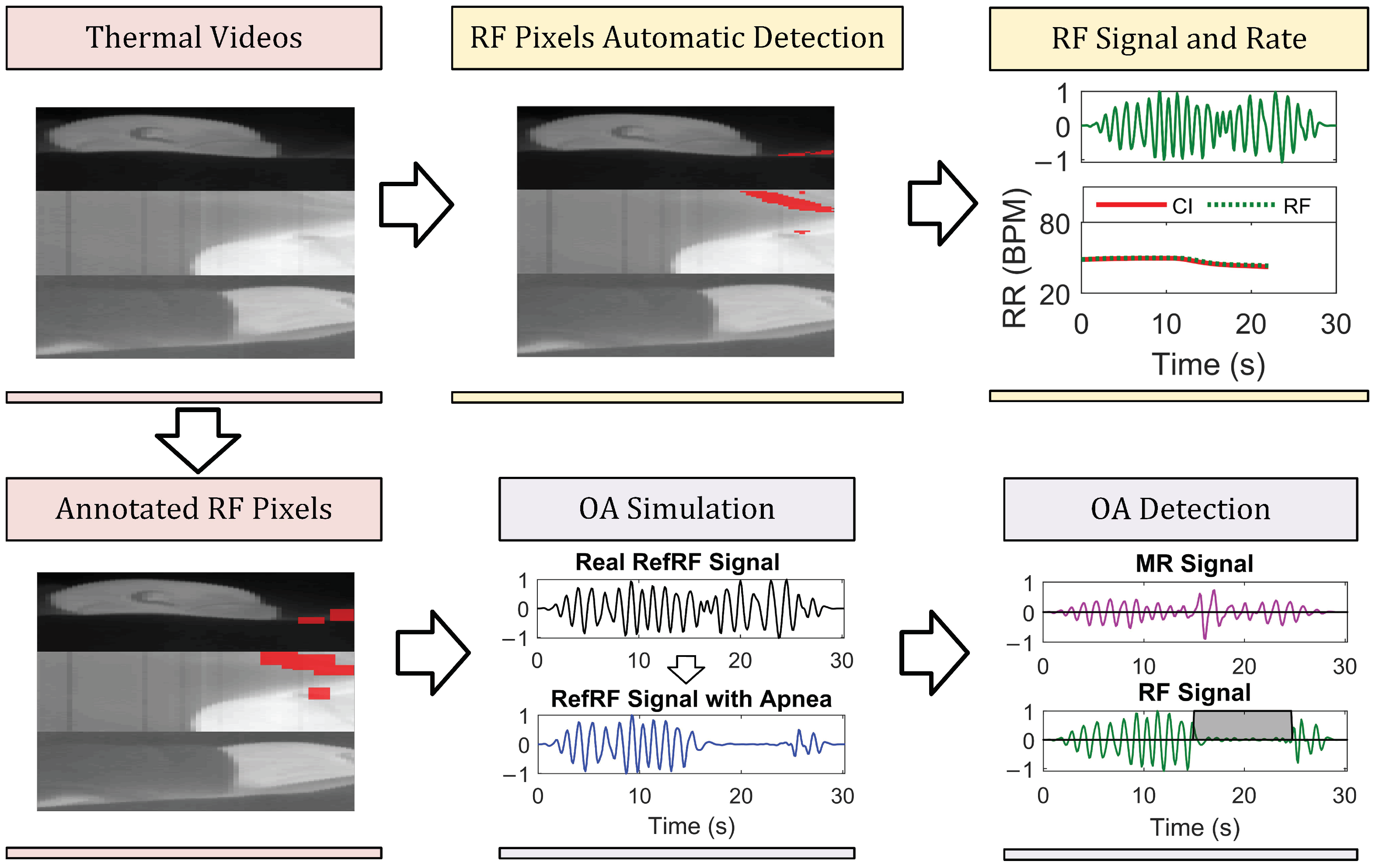 Automatic Separation of Respiratory Flow from Motion in Thermal Videos ...
