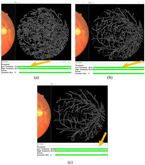 Sensors | Free Full-Text | Interactive Blood Vessel Segmentation from ...