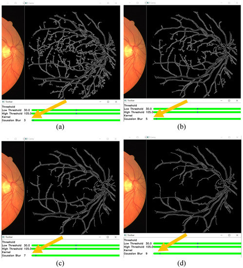 Sensors | Free Full-Text | Interactive Blood Vessel Segmentation from ...