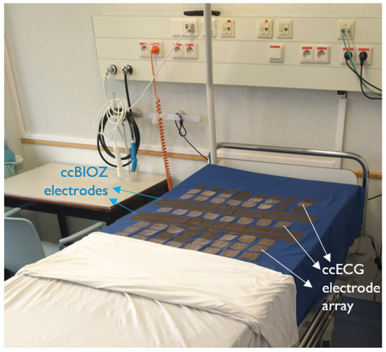 Capacitively-Coupled ECG and Respiration for Sleep–Wake Prediction and ...