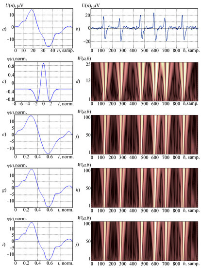Sensors | Free Full-Text | Polynomial, Neural Network, and Spline ...