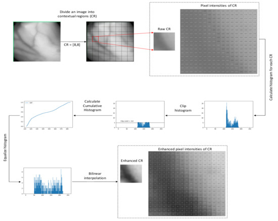 Dorsal Hand Vein Image Enhancement Using Fusion of CLAHE and Fuzzy Adaptive Gamma