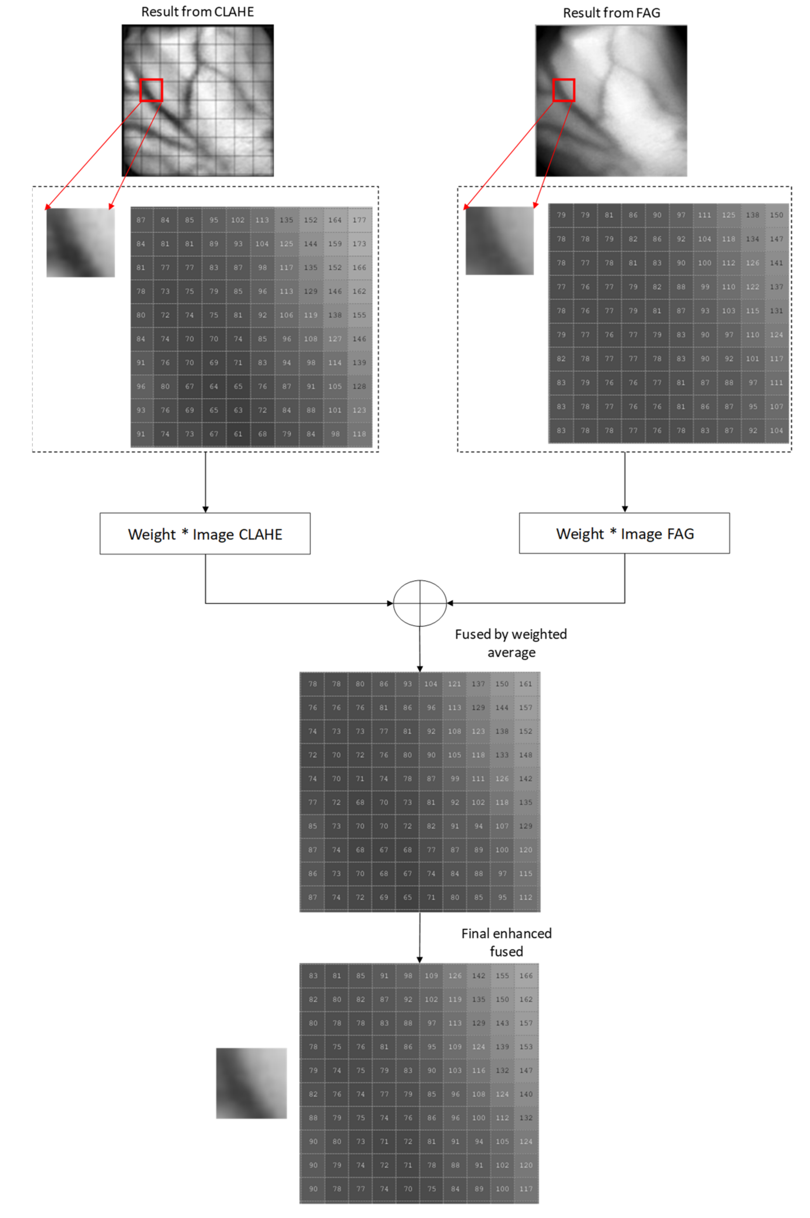 Dorsal Hand Vein Image Enhancement Using Fusion of CLAHE and Fuzzy Adaptive Gamma