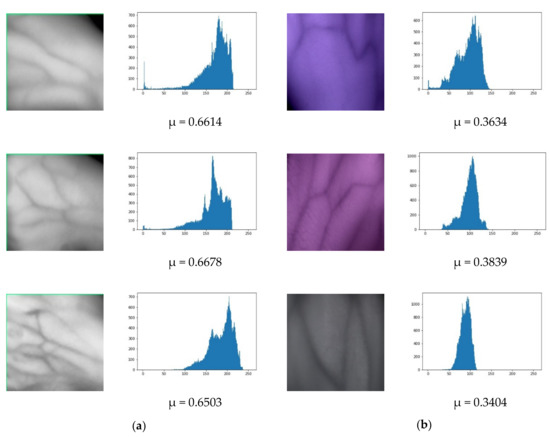 Dorsal Hand Vein Image Enhancement Using Fusion of CLAHE and Fuzzy Adaptive Gamma
