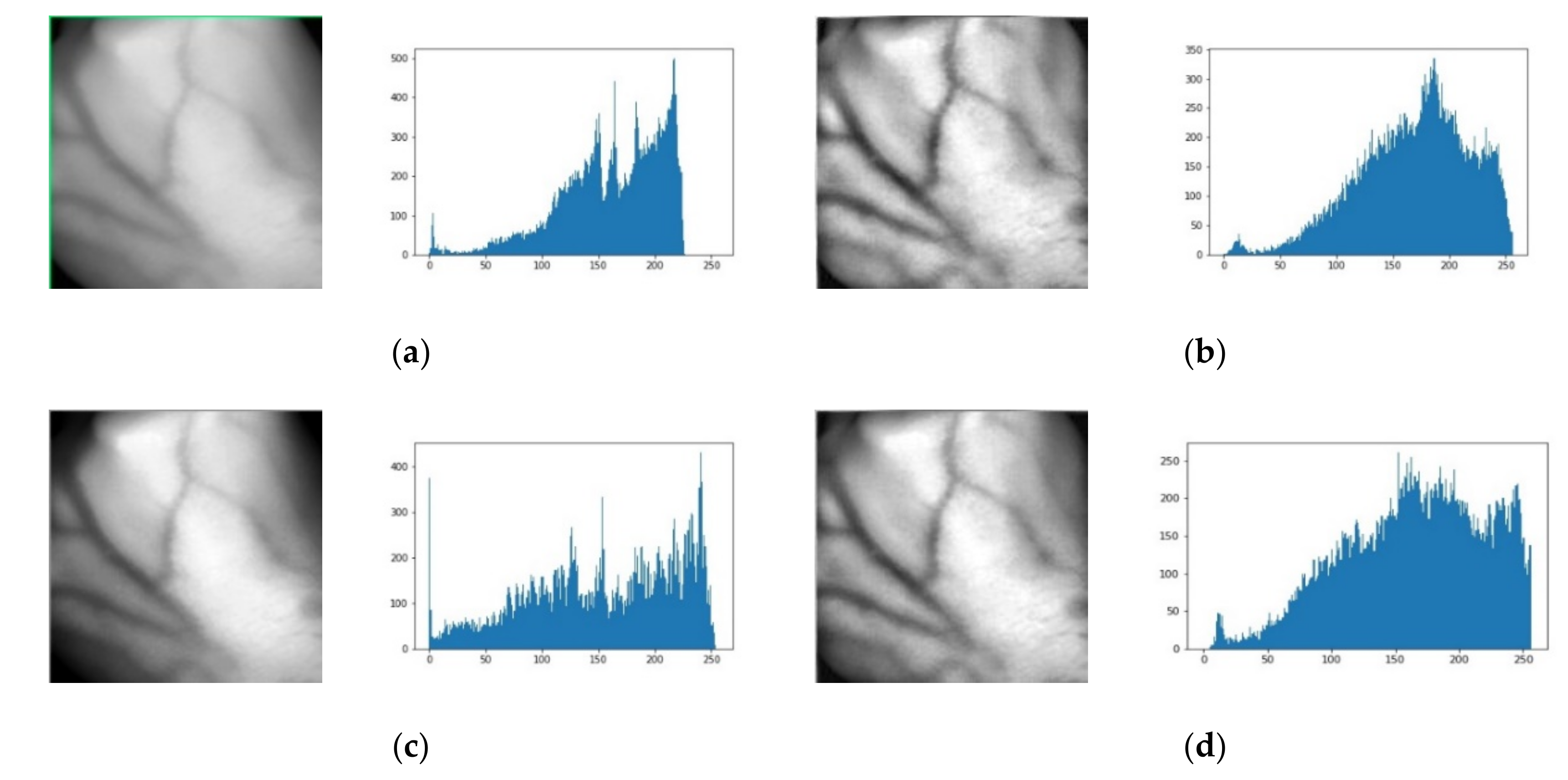 Dorsal Hand Vein Image Enhancement Using Fusion of CLAHE and Fuzzy ...