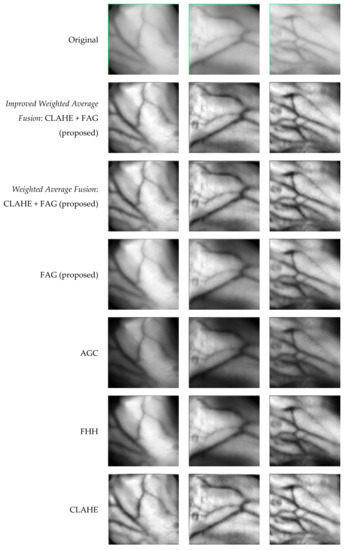 Dorsal Hand Vein Image Enhancement Using Fusion of CLAHE and Fuzzy Adaptive Gamma