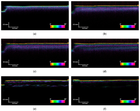 The Optical Coherence Tomography and Raman Spectroscopy for Sensing of ...