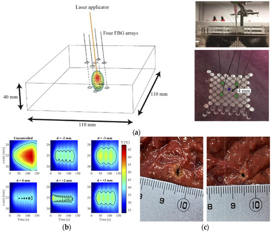 Recent Advances in Biomedical Photonic Sensors: A Focus on Optical ...