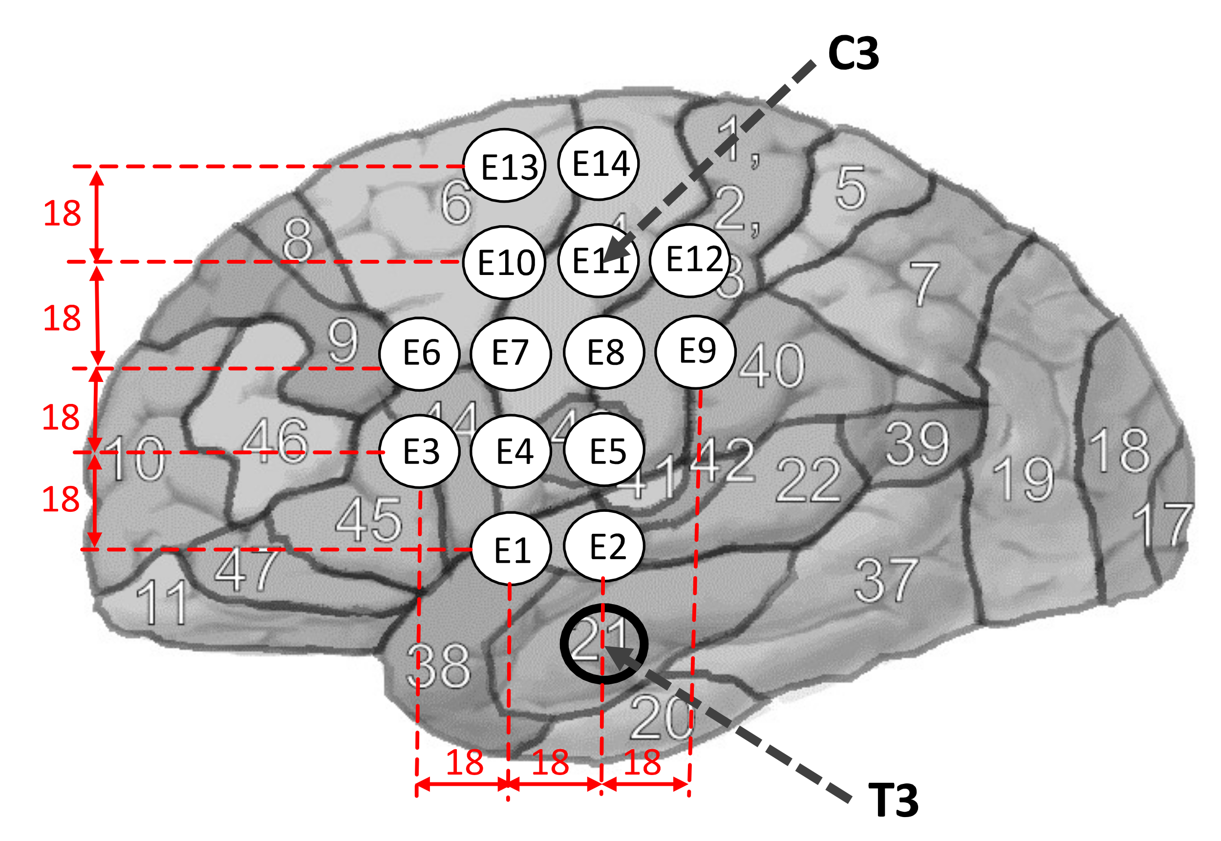 Recognition of EEG Signals from Imagined Vowels Using Deep Learning Methods