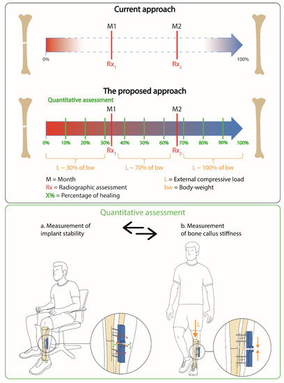 A Novel Capacitive Measurement Device for Longitudinal Monitoring of ...