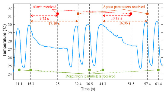 Towards Accurate, Cost-Effective, Ultra-Low-Power and Non-Invasive ...