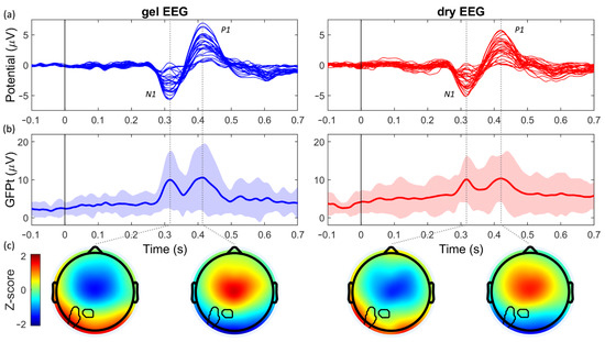 Validation of Soft Multipin Dry EEG Electrodes