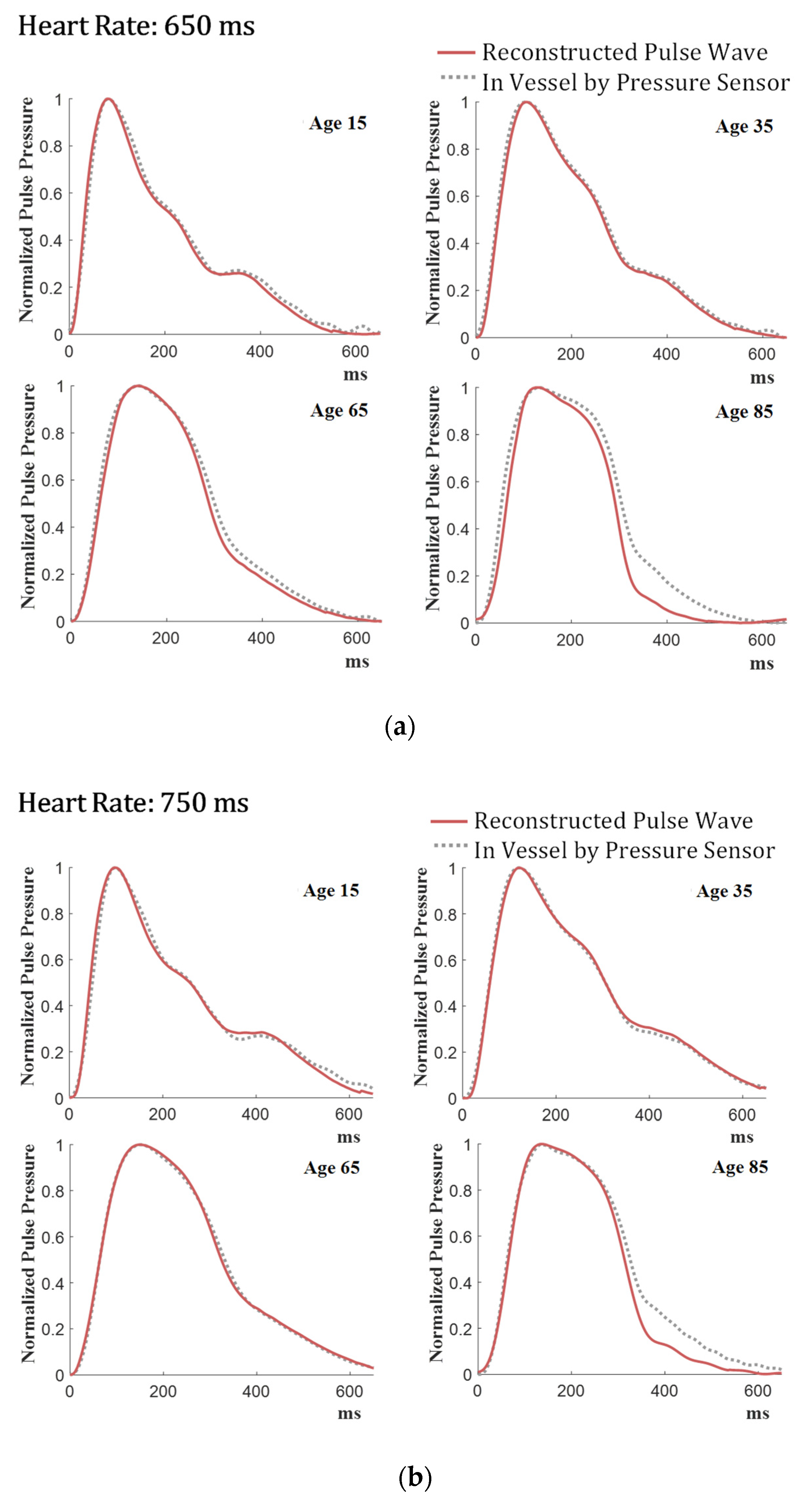 A Transfer Function Model Development for Reconstructing Radial Pulse ...