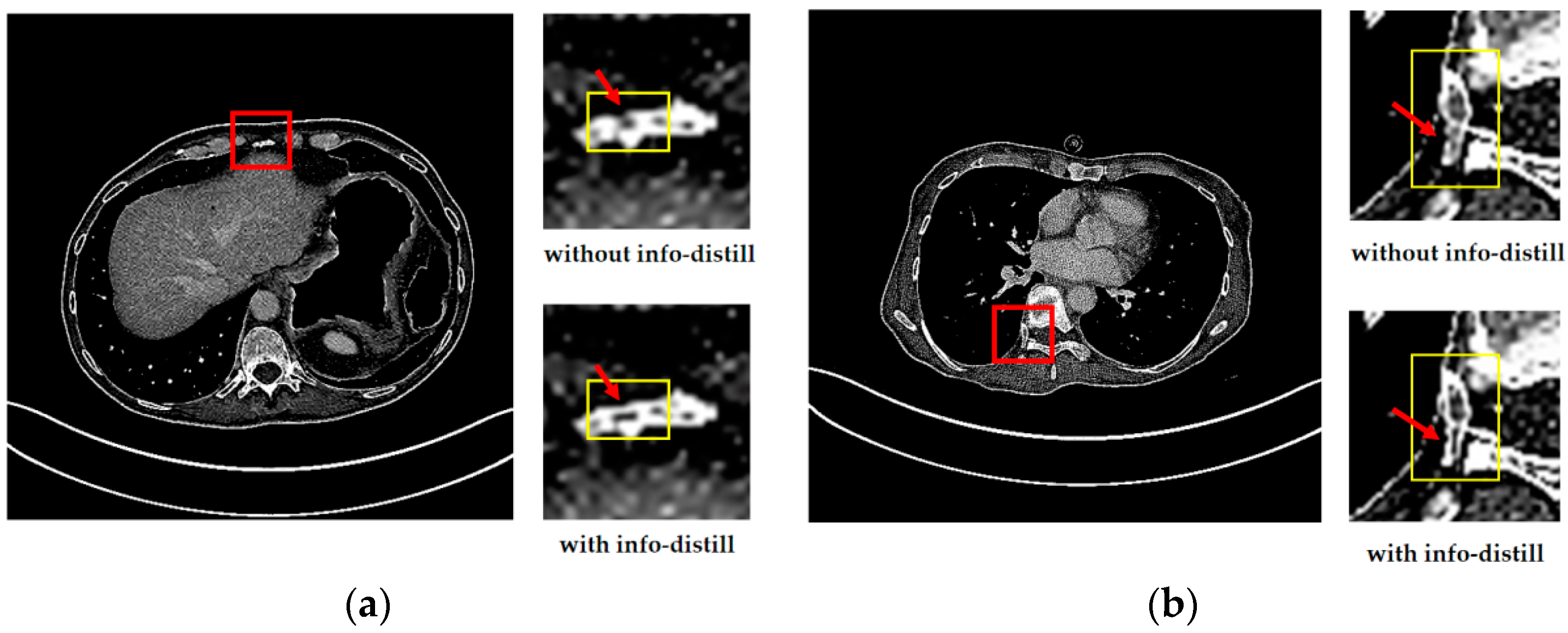 Sensors | Free Full-Text | Super-Resolution Network with Information Distillation and Multi ...