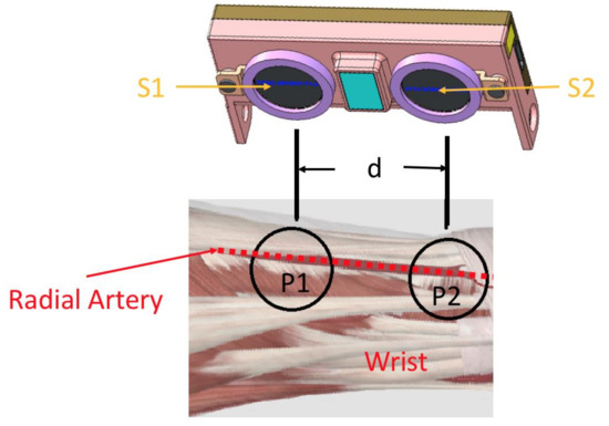 Piezoelectric Sensor for the Monitoring of Arterial Pulse Wave ...
