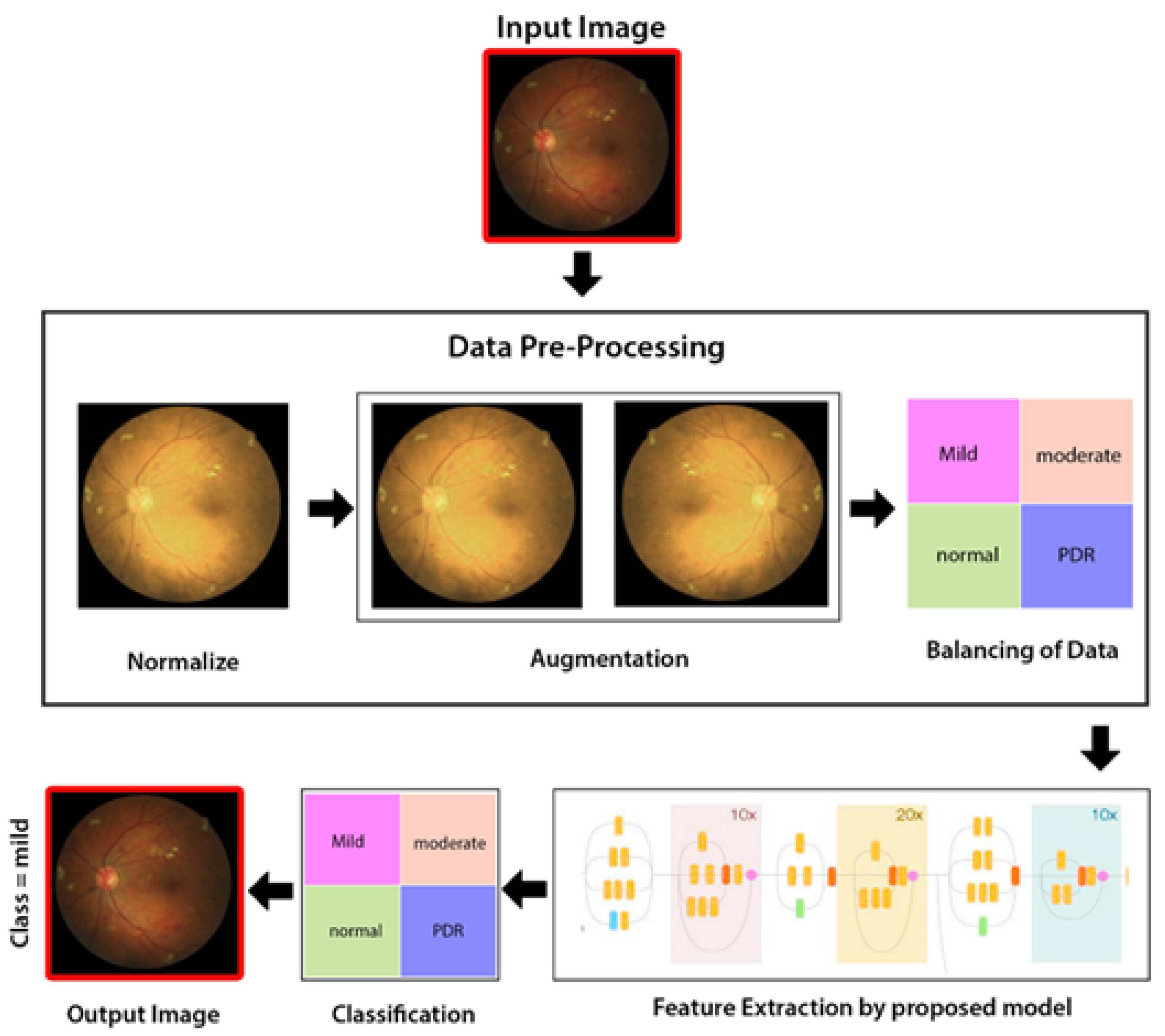 Severity Grading and Early Retinopathy Lesion Detection through Hybrid ...
