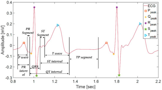 ECG Authentication Based on Non-Linear Normalization under Various ...