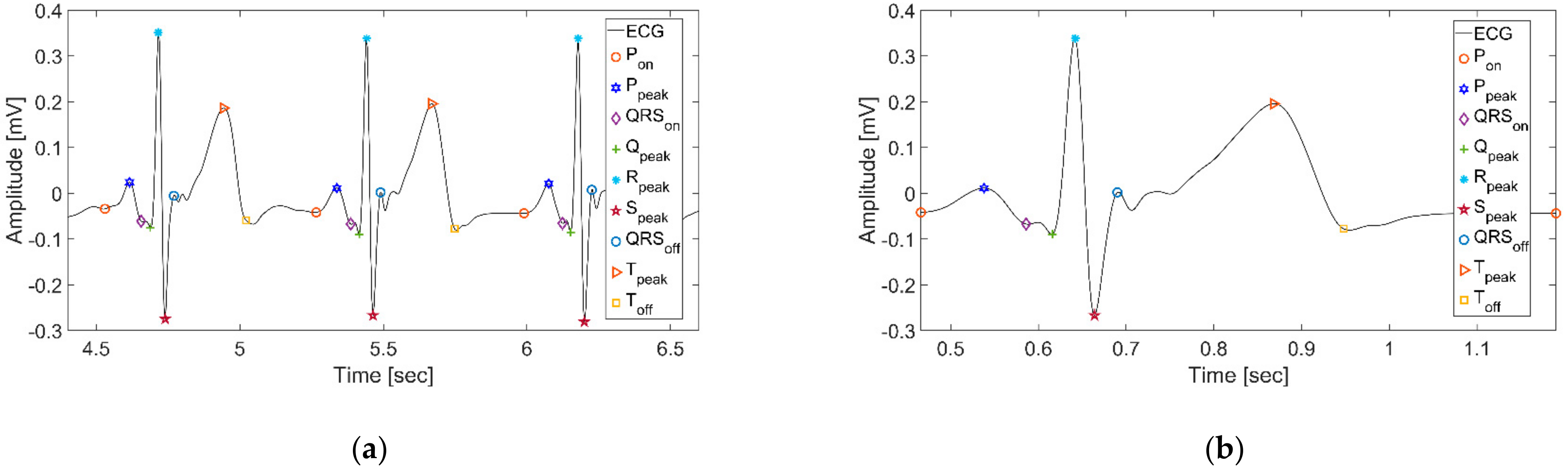 ECG Authentication Based on Non-Linear Normalization under Various Physiological Conditions