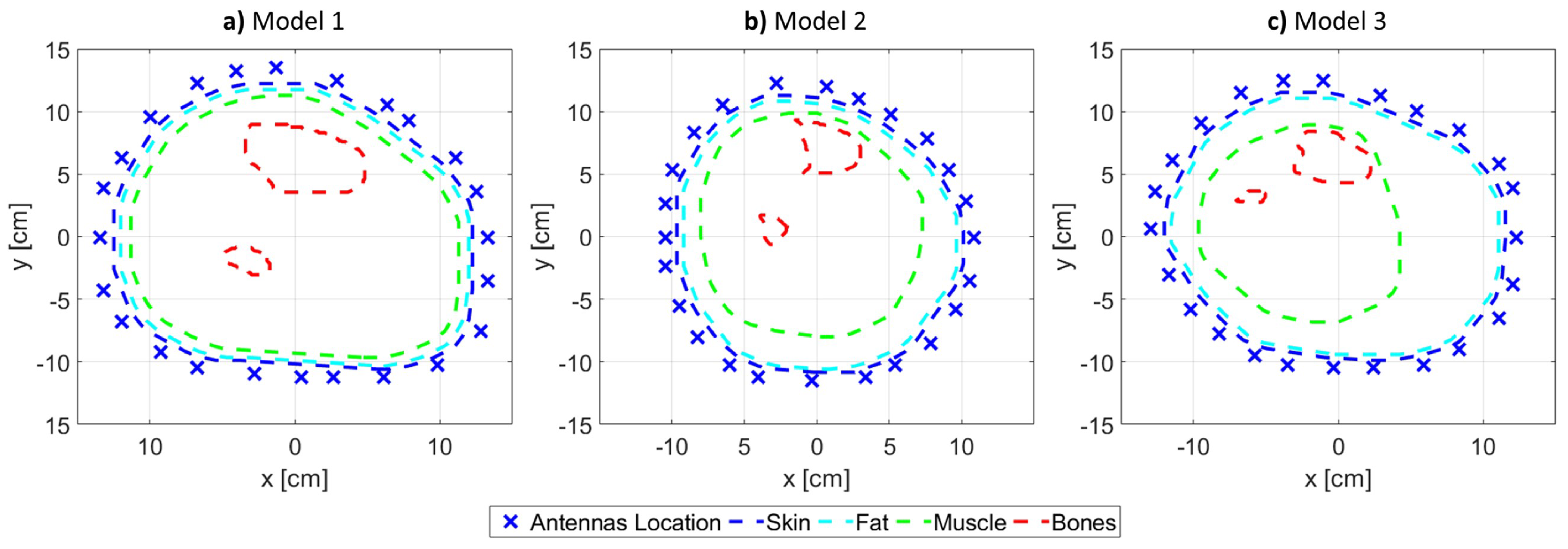 Sensors | Free Full-Text | Monitoring Bone Density Using Microwave ...