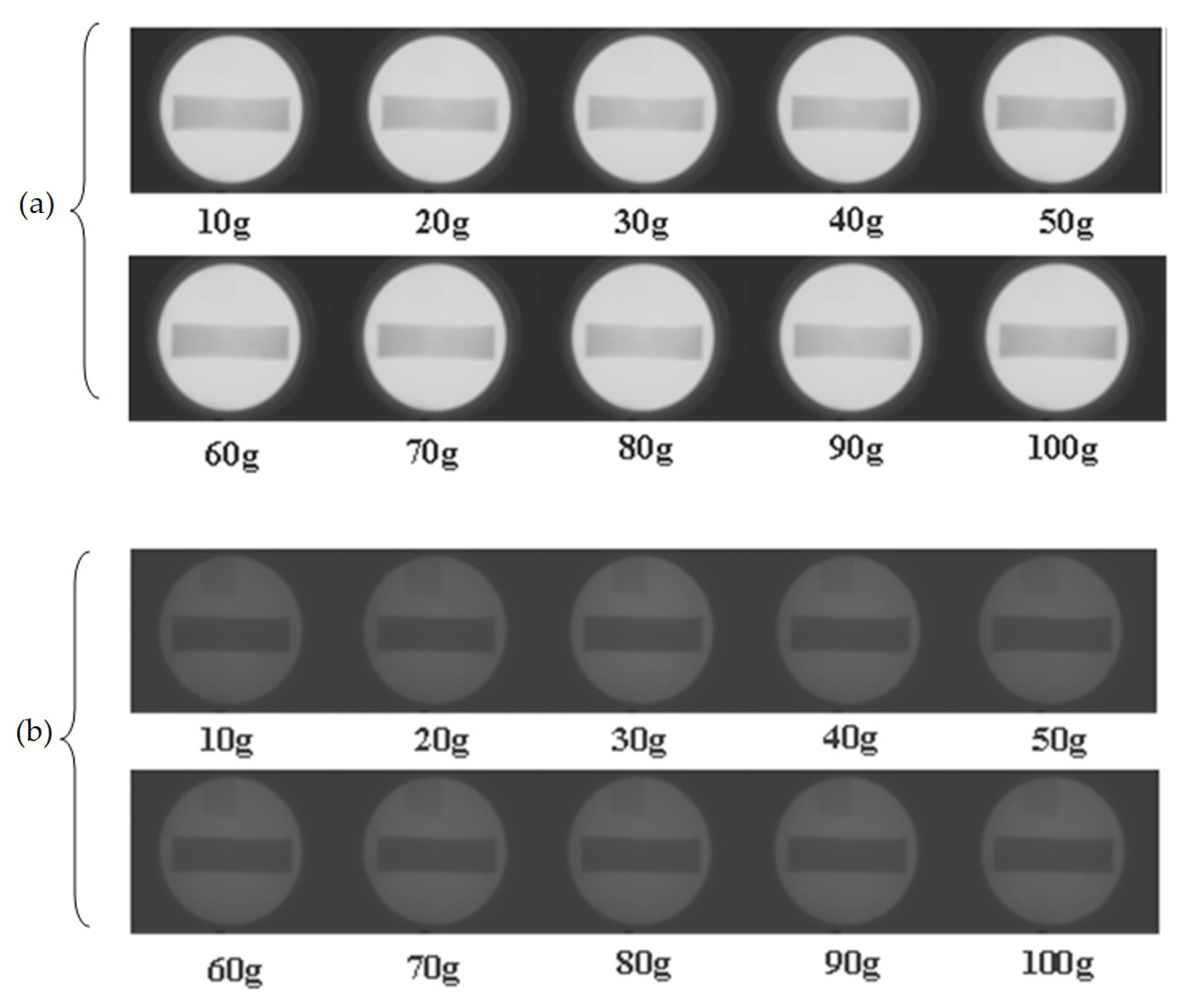 Bone Mineral Density Screening System Using CMOS-Sensor X-ray Detector