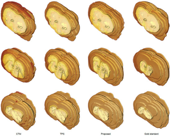 Sensors | Free Full-Text | Segmentation of Rat Brains and Cerebral ...