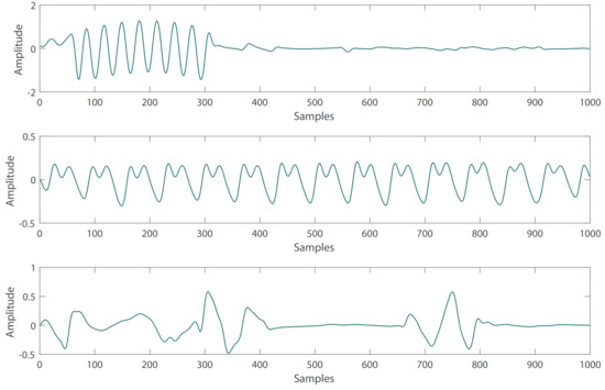 A Continuous Blood Pressure Estimation Method Using ...