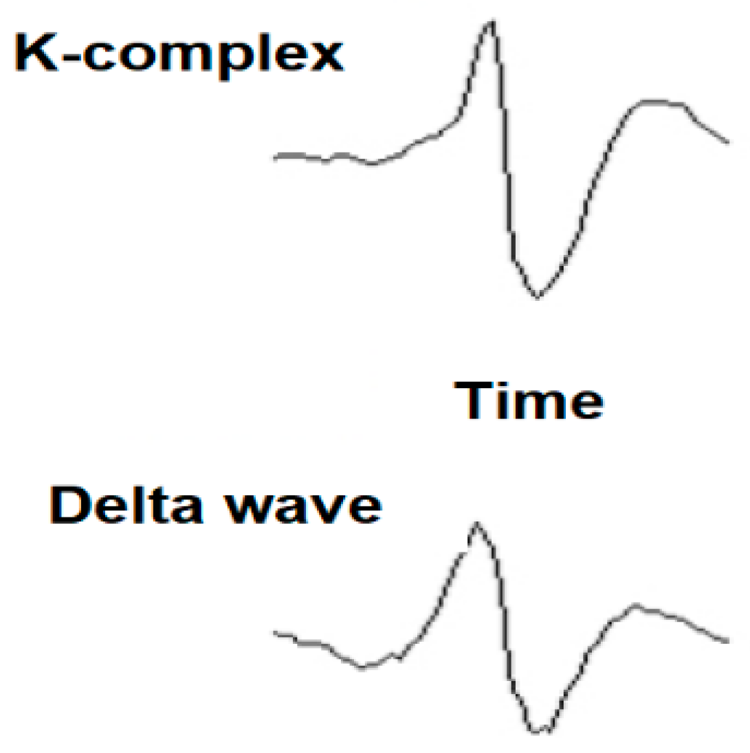 Automatic Detection of K-Complexes Using the Cohen Class Recursiveness ...