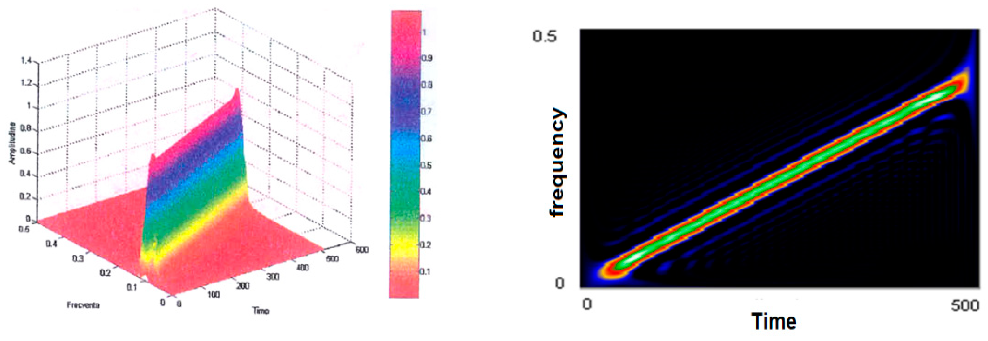Automatic Detection of K-Complexes Using the Cohen Class Recursiveness and Reallocation Method ...