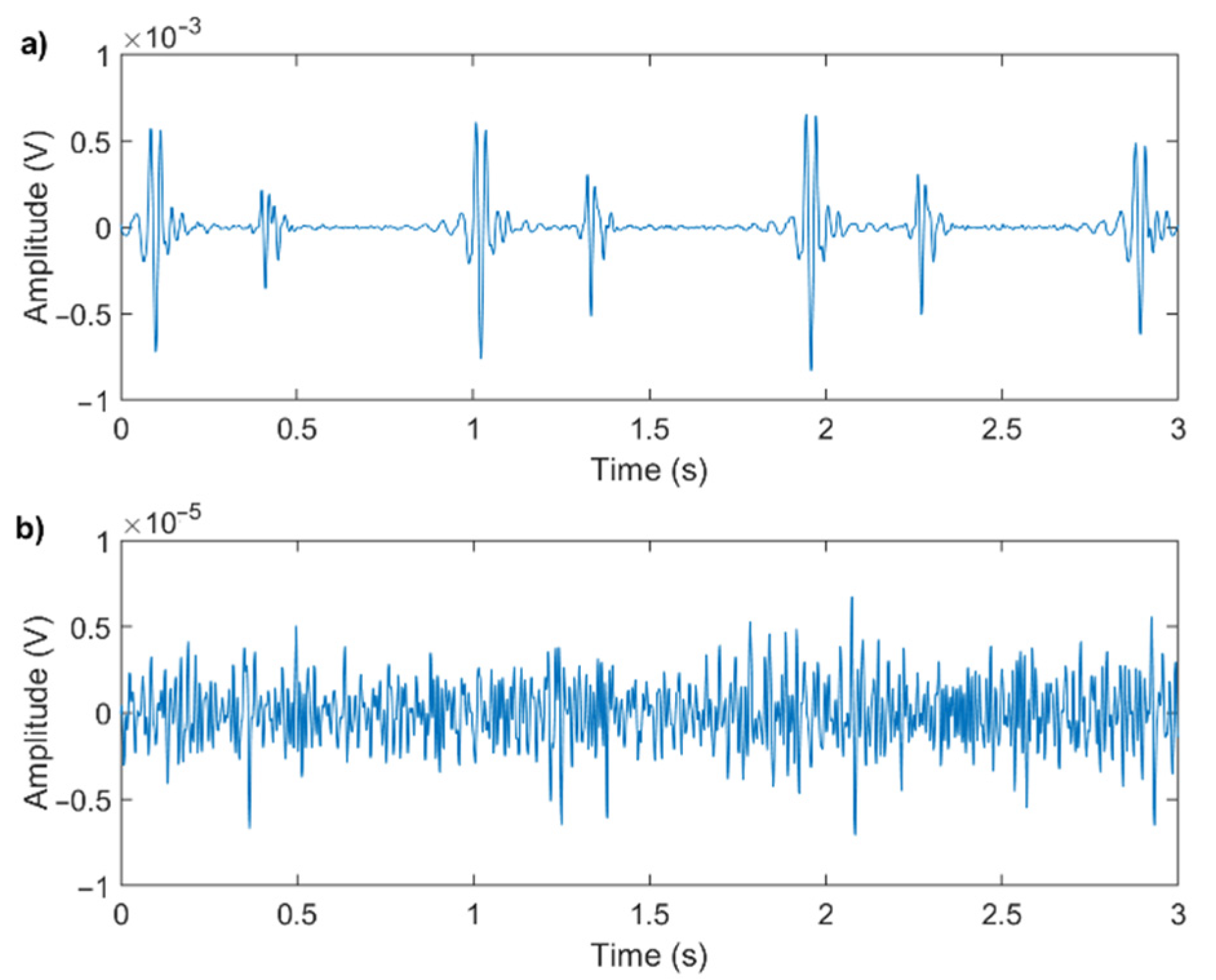 Automated Assessment of the Quality of Phonocardographic Recordings ...