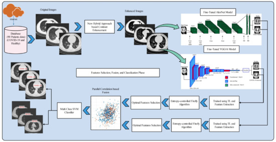 Sensors | Free Full-Text | COVID-19 Case Recognition from Chest CT Images by Deep Learning ...
