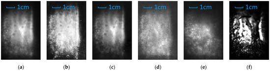 Layer-Resolving Terahertz Light-Field Imaging Based on Angular Intensity Filtering Method