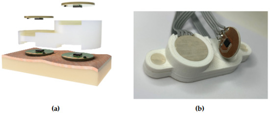 Smart Face Mask with an Integrated Heat Flux Sensor for Fast and Remote ...