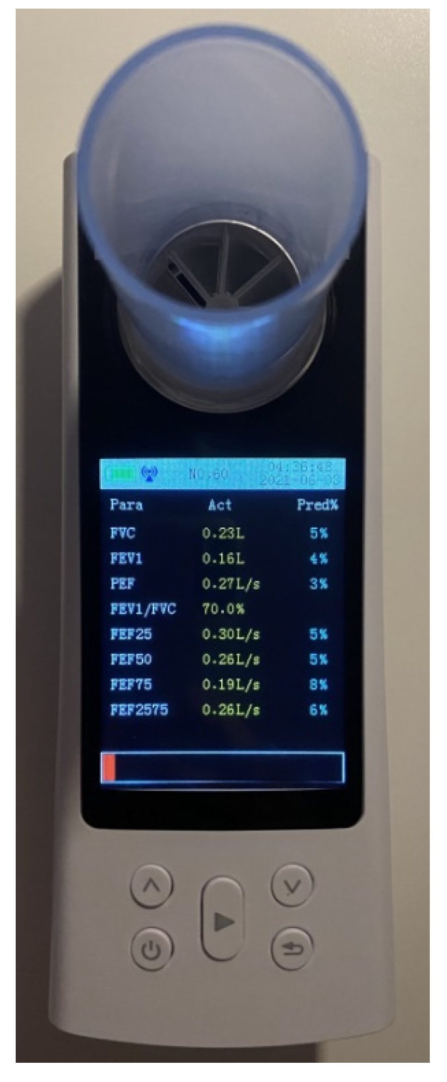 Non-Contact Spirometry Using a Mobile Thermal Camera and AI Regression