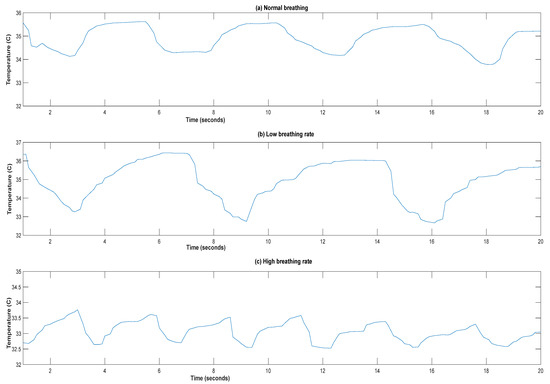 Sensors | Free Full-Text | Non-Contact Spirometry Using a Mobile ...